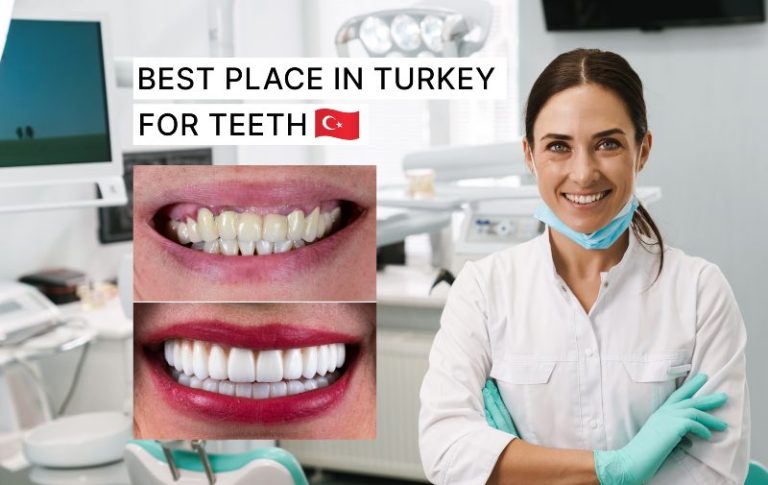 Best Place in Turkey for Teeth – Parmire